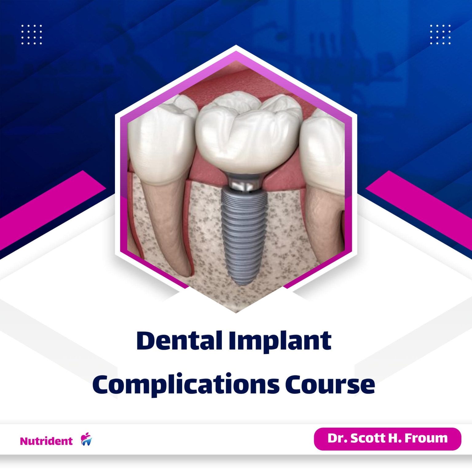 Dental implant complications course - Nutrident