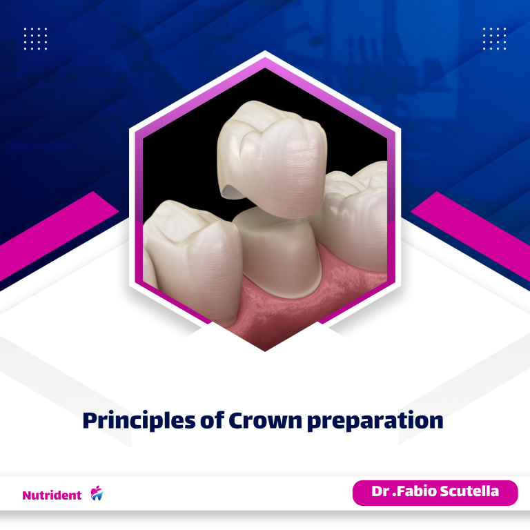 Principles Of Crown Preparation - Nutrident